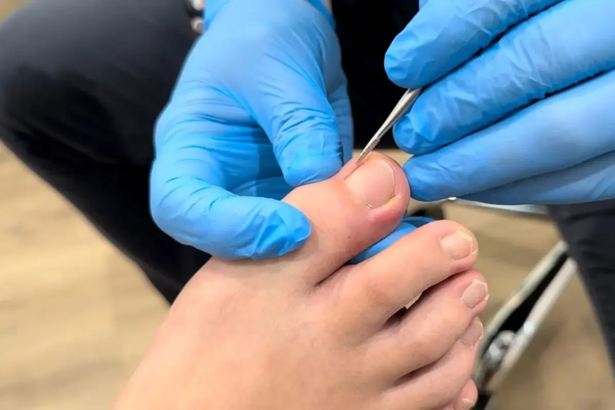 Managing Skin and Nail Conditions of the Foot - Podiatrist's Advice ...