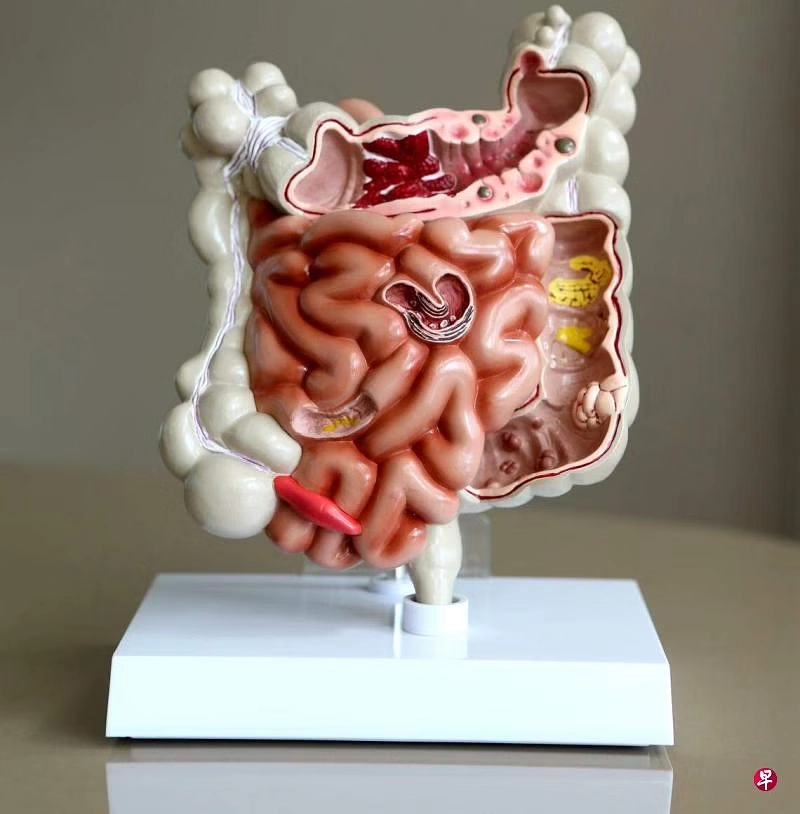 Holding in the urge to pass motion causes constipation? | %%sitename%%